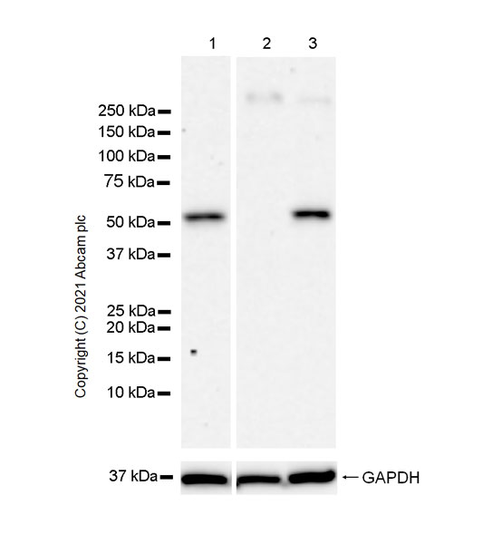 Anti-GABA A Receptor gamma 2/GABRG2 antibody [EPR25325-5] (ab288564 ...