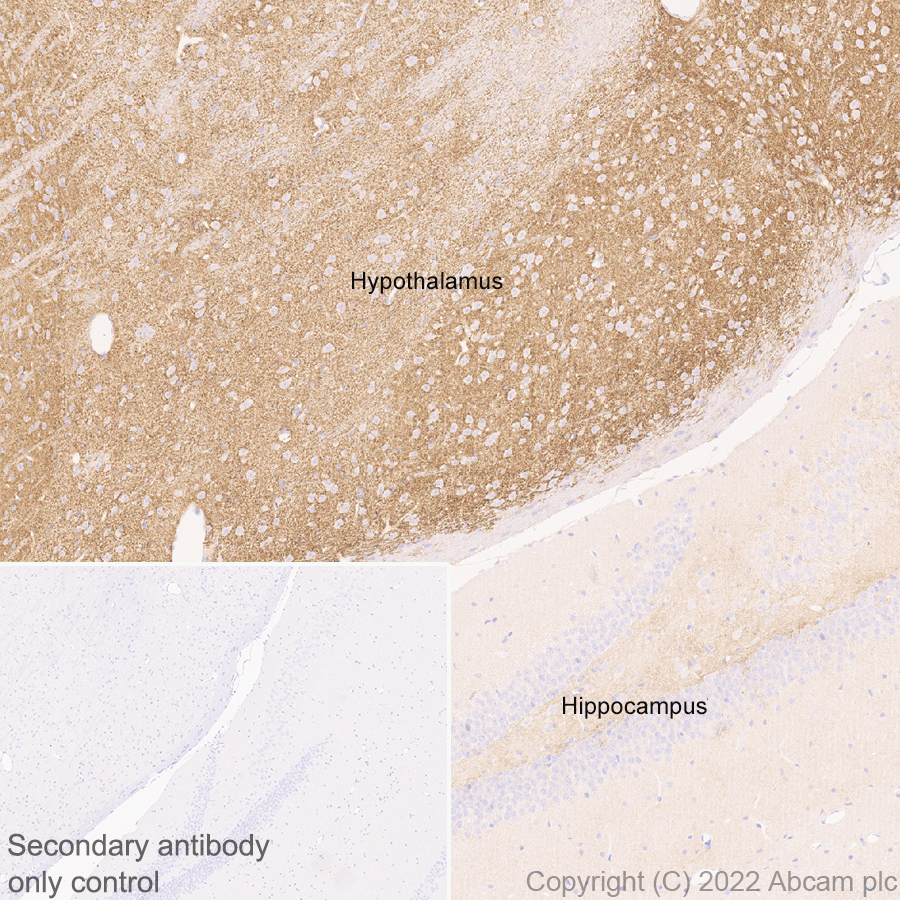 Anti-GABA Transporter 3 / GAT 3 antibody [EPR25153-38] (ab300559) | Abcam