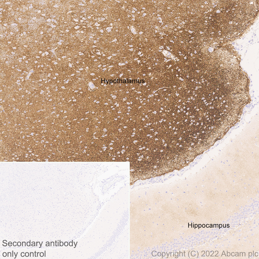 Anti-GABA Transporter 3 / GAT 3 antibody [EPR25153-38] (ab300559) | Abcam
