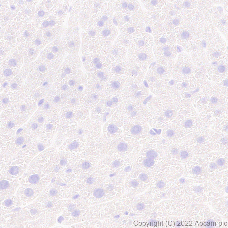 Anti-GABA Transporter 3 / GAT 3 antibody [EPR25153-38] (ab300559) | Abcam