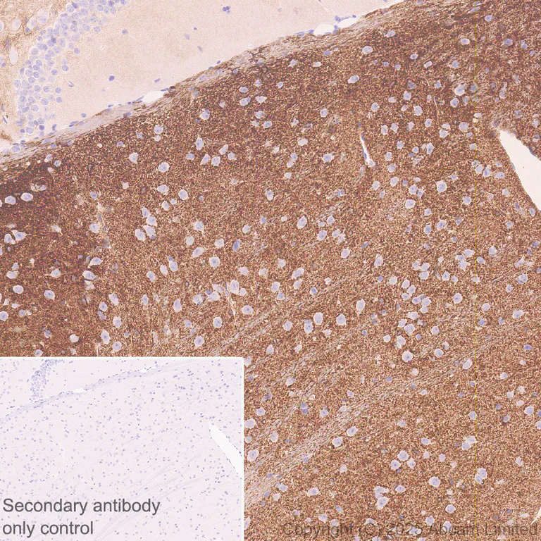 Anti-GABA Transporter 3 / GAT 3 antibody [EPR25153-38] (ab300559) | Abcam