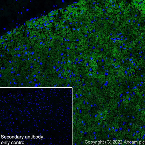 Anti-GABA Transporter 3 / GAT 3 antibody [EPR25153-38] (ab300559) | Abcam