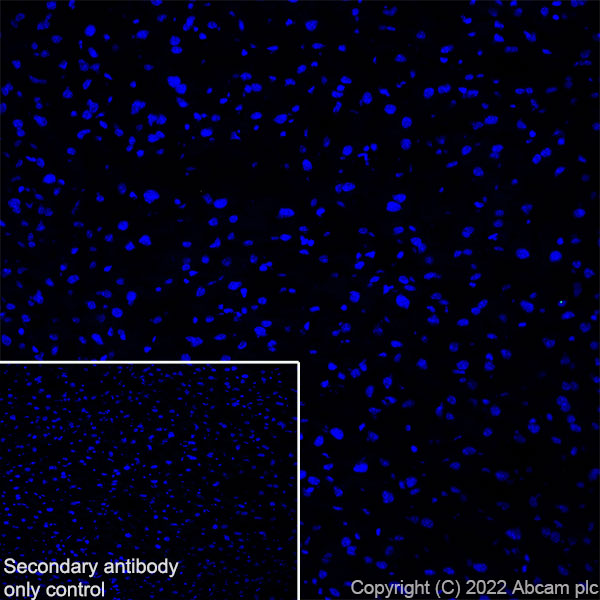 Anti-GABA Transporter 3 / GAT 3 antibody [EPR25153-38] (ab300559) | Abcam