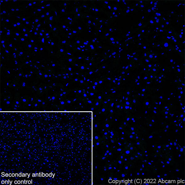 Anti-GABA Transporter 3 / GAT 3 antibody [EPR25153-38] (ab300559) | Abcam