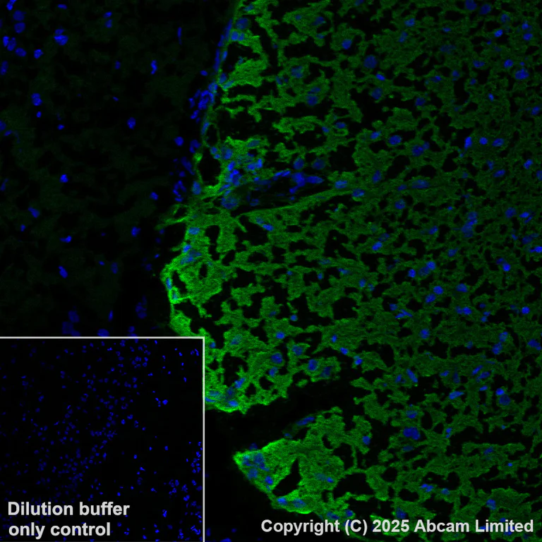 Anti-GABA Transporter 3 / GAT 3 antibody [EPR25153-38] (ab300559) | Abcam