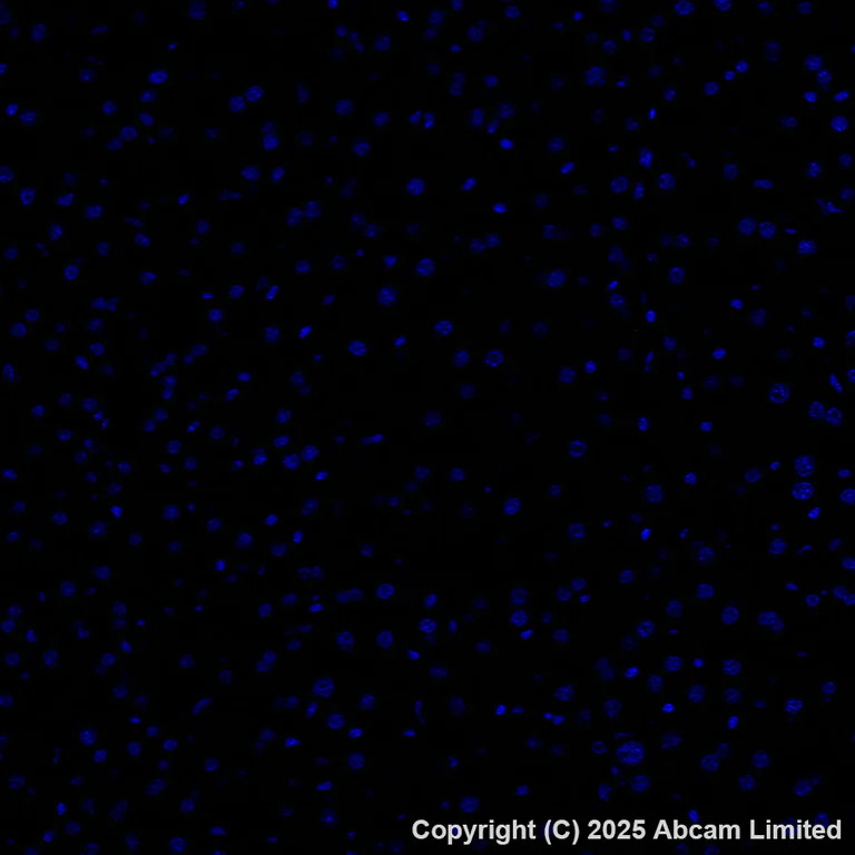 Anti-GABA Transporter 3 / GAT 3 antibody [EPR25153-38] (ab300559) | Abcam