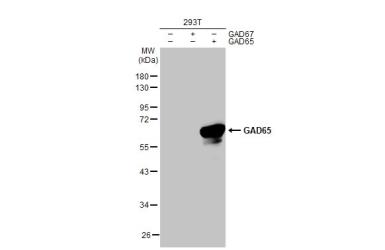 Anti-GAD65 antibody [HL1187] - BSA and Azide free (ab307489) | Abcam