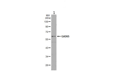Anti-GAD65 antibody [HL1187] - BSA and Azide free (ab307489) | Abcam