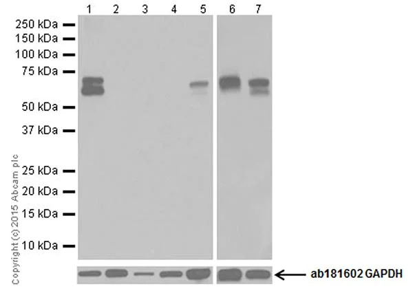 GAD65 + GAD67抗体[EPR19366] (ab183999)| Abcam中文官网