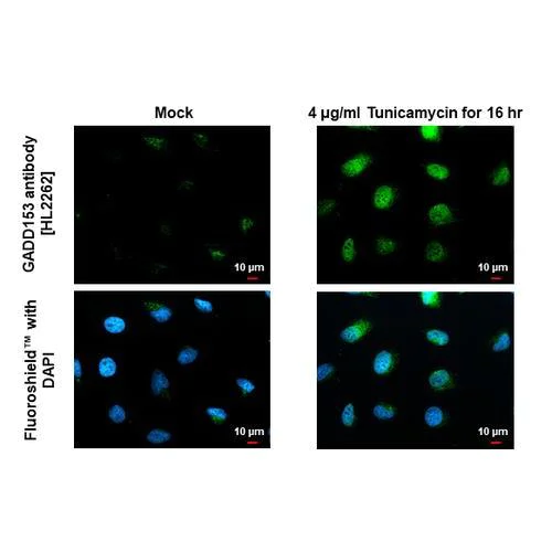 Anti-GADD153 antibody [HL2262] (ab317182) | Abcam