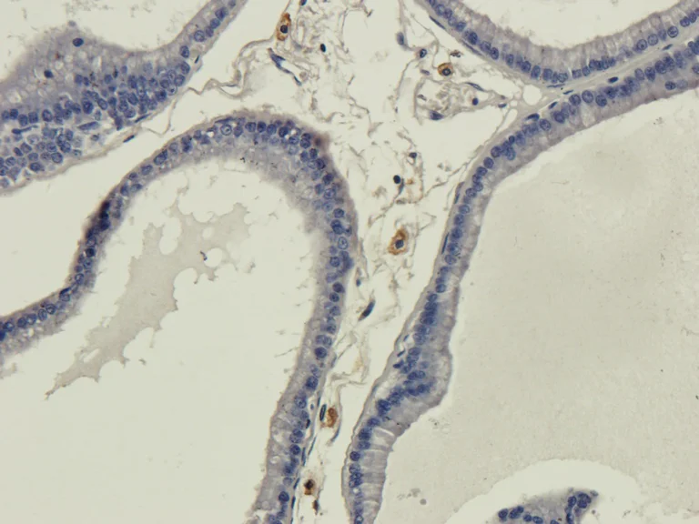 Anti-Galanin antibody [4B3] (ab245676) | Abcam