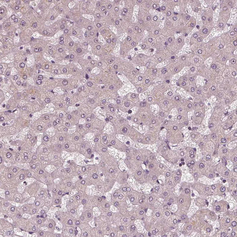 Anti-Galanin antibody (ab262924) | Abcam