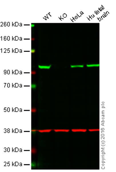 Anti-gamma Adaptin antibody [EPR9875(B)] (ab167153) | Abcam