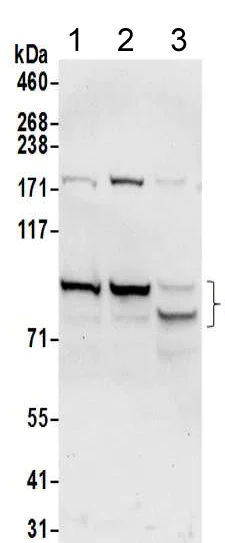 Anti-gamma Adaptin antibody - N-terminal (ab205953) | Abcam