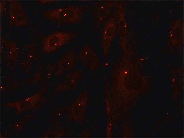 Anti-gamma Tubulin antibody - Centrosome Marker (ab11321) | Abcam