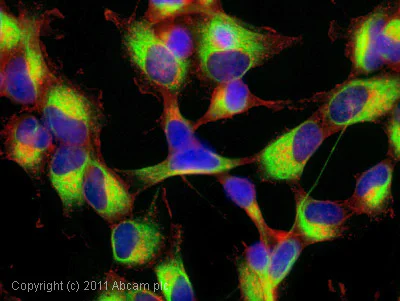 Anti-Ganglioside GD3 antibody [R24] Mouse monoclonal (ab11779) | Abcam
