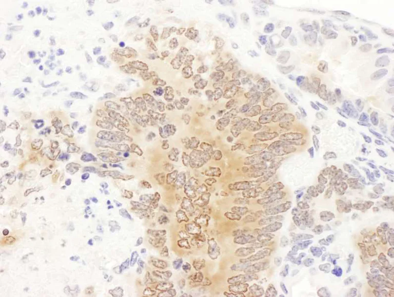 Anti-GART antibody (ab187716) | Abcam