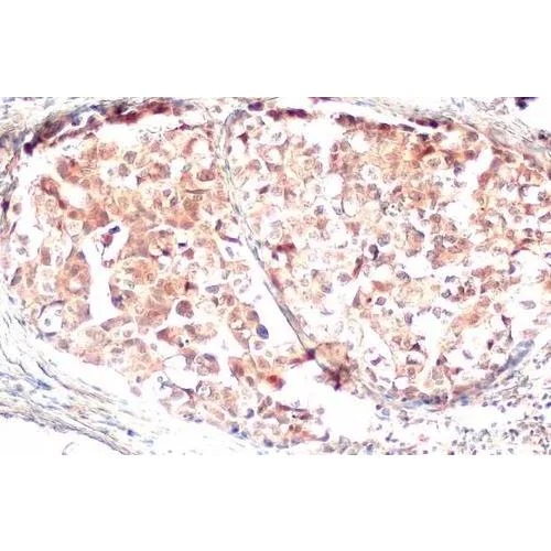 Anti-Gasdermin D antibody [HL1430] (ab317086) | Abcam中文官网