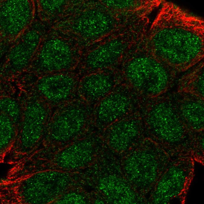 Anti-GBP2 antibody (ab247040) | Abcam