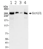 Anti-GCN1 antibody. Rabbit polyclonal (ab86139) | Abcam