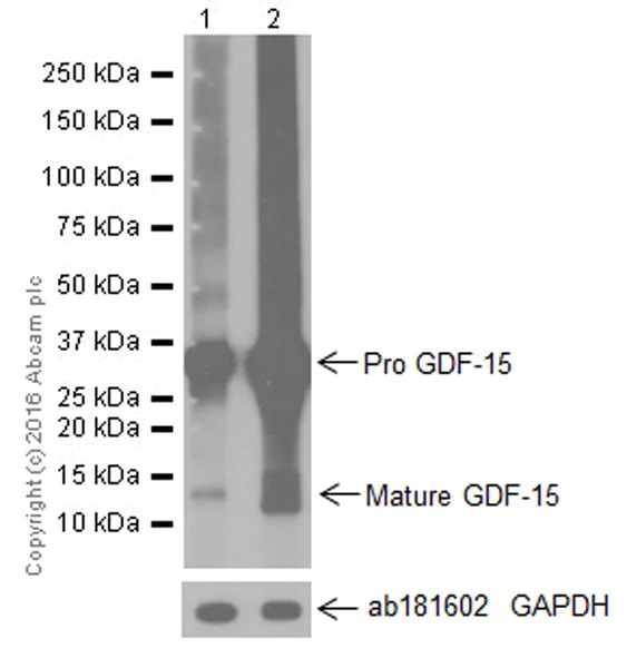 GDF15抗体[EPR19939] (ab206414)| Abcam中文官网