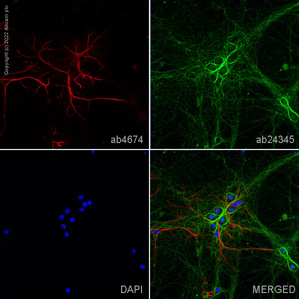 Anti-GFAP antibody. Chicken Polyclonal (ab4674) | Abcam