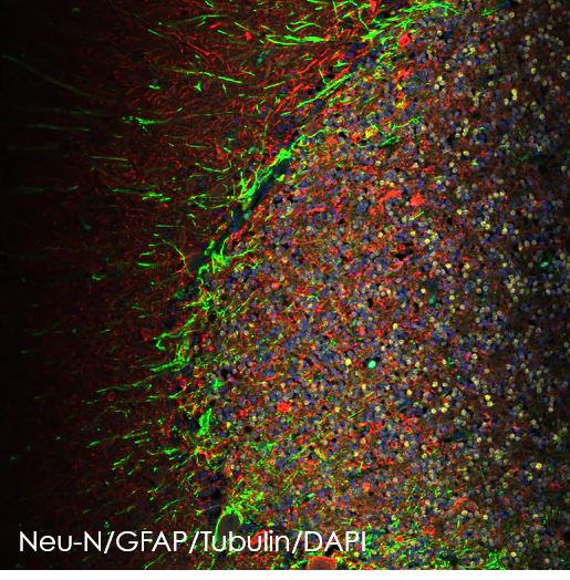 Anti-GFAP antibody [EPR1034Y] 20 ul size (ab68428) | Abcam
