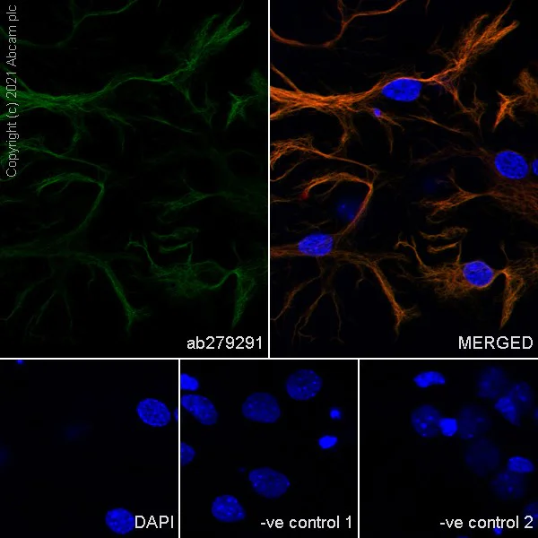 Anti-GFAP antibody [EPR1034Y] - Rat IgG2a (Chimeric) (ab279291) | Abcam