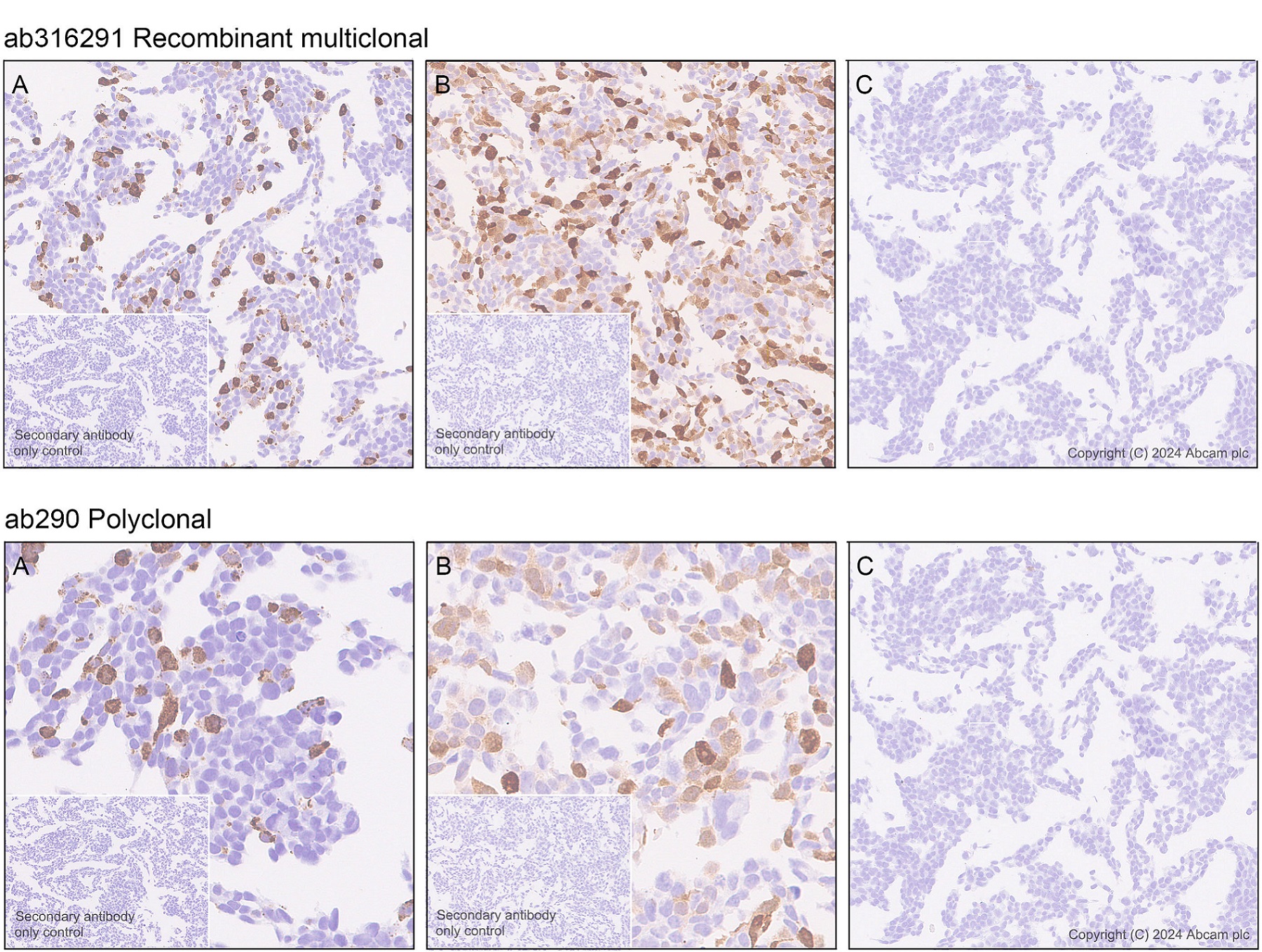 Anti-GFP antibody [RM1064] (ab316291) | Abcam