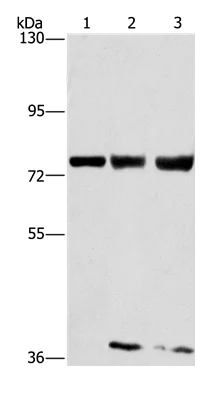 Anti-GGCX antibody (ab197982) | Abcam