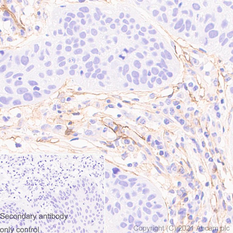 Anti-GGT5 antibody [EPR24682-102] (ab283267) | Abcam