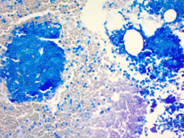 Giemsa Stain Kit (ab150670)| Abcam中文官网