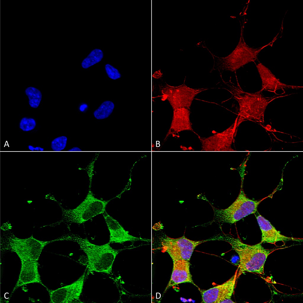 Anti-GIT1 antibody [S39B-8] - C-terminal (ab240873) | Abcam