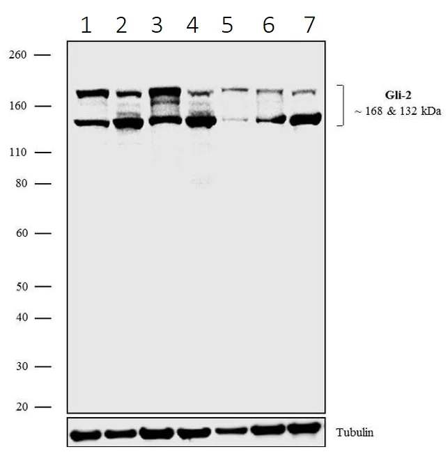 Anti-Gli2 antibody [9HCLC] (ab277800) | Abcam