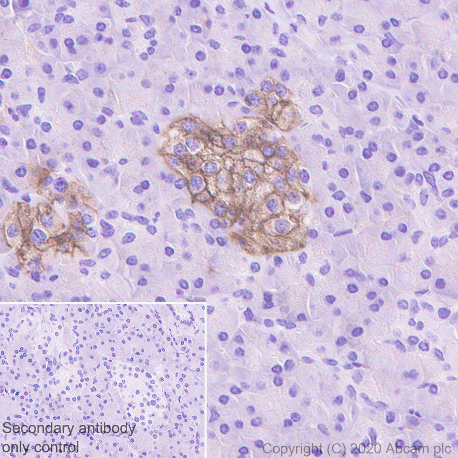 Anti-GLP-1R antibody [EPR23507-57] Rabbit monoclonal (ab254352) | Abcam