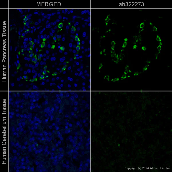 Anti-Glucagon [EP3070] – Mouse IgG1 (Chimeric) (ab322273) | Abcam中文官网