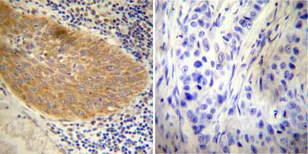 Anti-Glucocorticoid Receptor 抗体 (ab3578) | Abcam