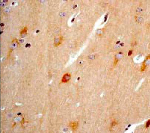 Anti-Glutamate Receptor 1 (AMPA subtype) antibody [E308] (ab32436) | Abcam