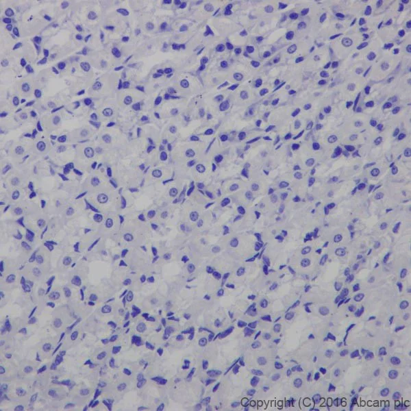 Anti-Glutamate Receptor 1 (AMPA subtype) antibody [EPR19522] (ab183797 ...