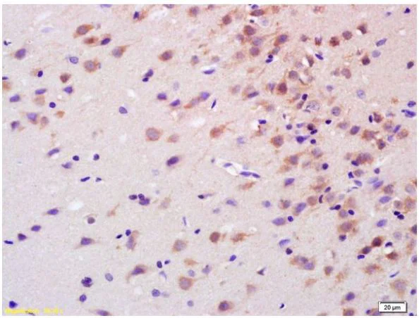 Glypican 1/ GPC1抗体 (ab217339)| Abcam中文官网