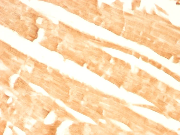 Glypican 3抗体[GPC3/863] (ab216606)| Abcam中文官网