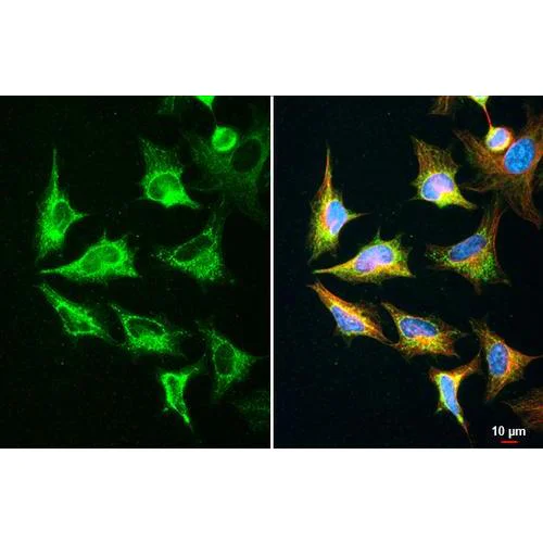 Anti-GNAI1 + GNAI2 + GNAI3 antibody [HL2093] (ab317135) | Abcam中文官网
