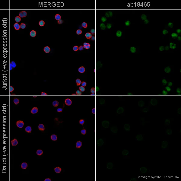 Goat Anti-Rabbit IgG (Alexa Fluor® 594) preadsorbed secondary antibody ...