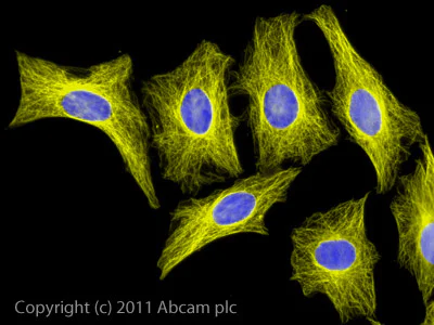Goat Anti-Rat IgG H&L (Alexa Fluor® 555) (ab150158) | Abcam