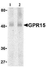 Anti-GPCR GPR15 antibody (ab8104) | Abcam