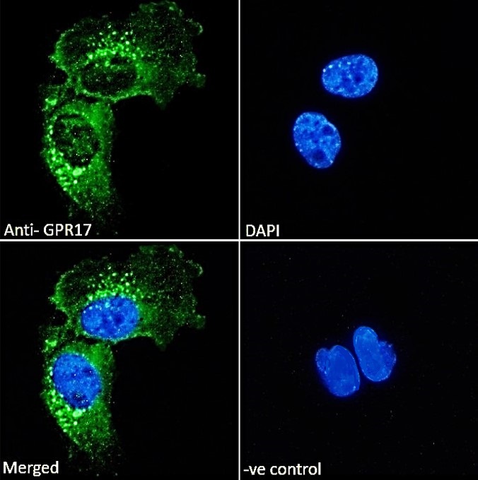 Anti-GPCR GPR17 antibody (ab106781) | Abcam