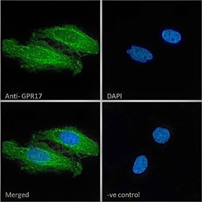 Anti-GPCR GPR17 antibody (ab106781) | Abcam