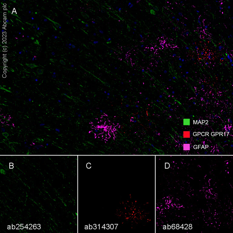 Anti-GPCR GPR17 抗体 [EPR26422-118] (ab314307) | Abcam