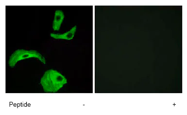 GPCR GPR18抗体 (ab76258)| Abcam中文官网