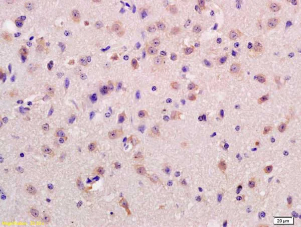 Anti-GPCR GPR37 antibody (ab218134) | Abcam
